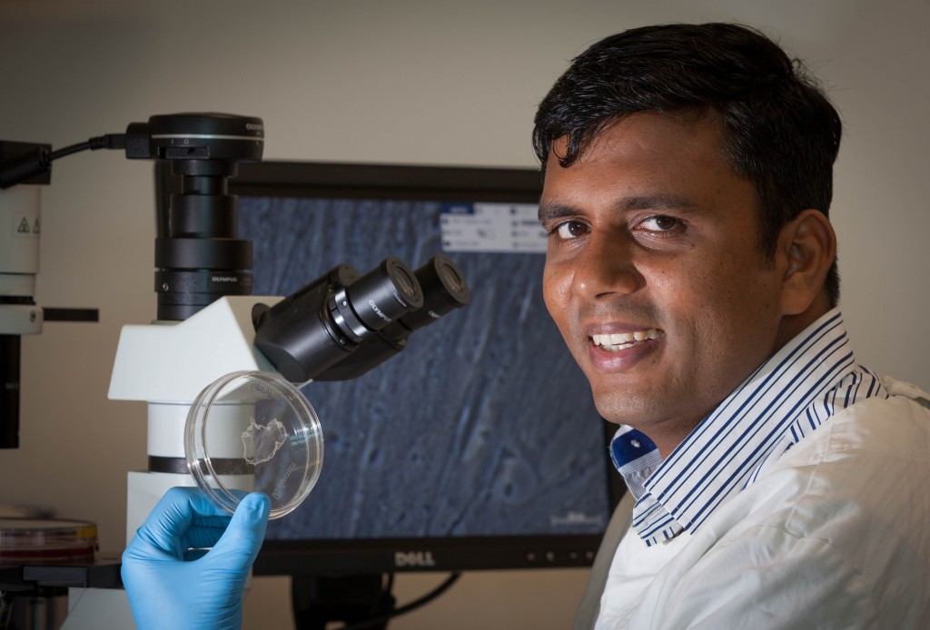 New treatment for a common knee injury – Griffith News