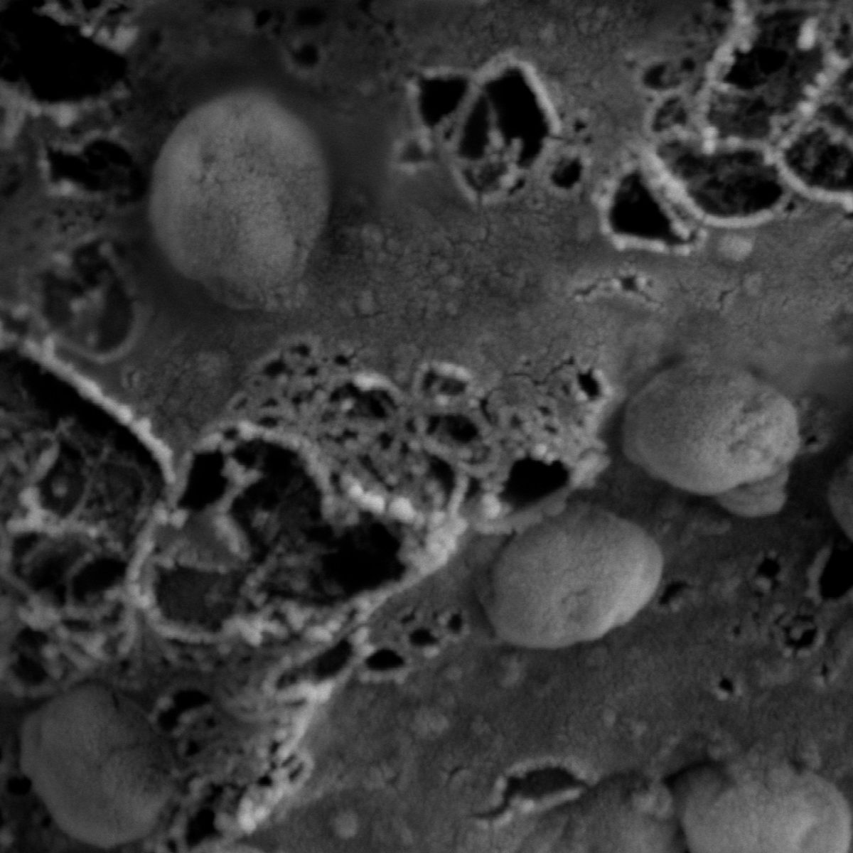 Researchers use novel method to block HIV in mice – Griffith News