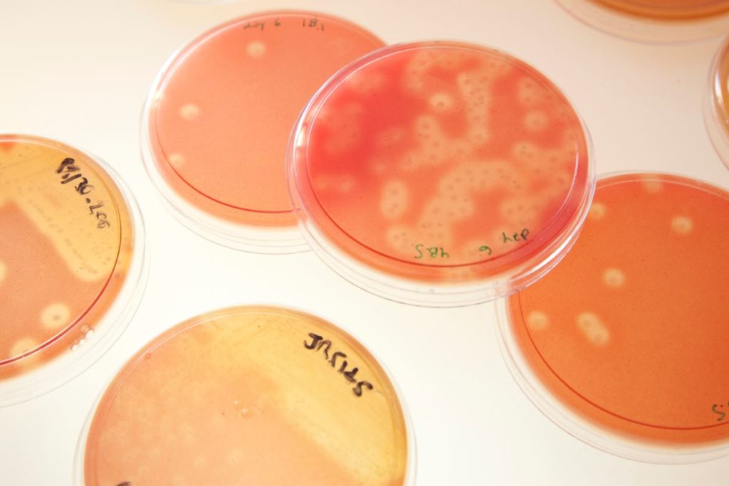 Researchers find Strep A’s Achilles heel with potential vaccine to ...