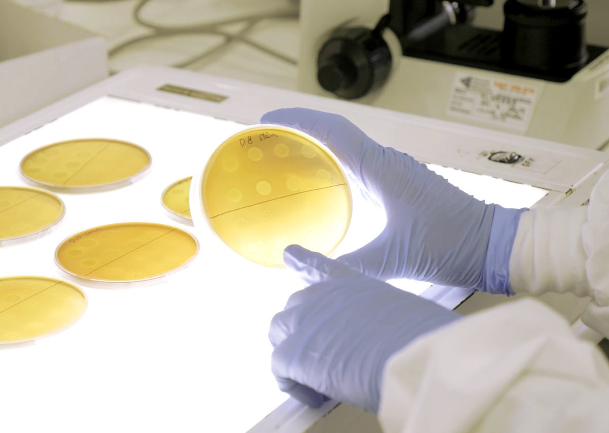 Griffith unlocking the secrets to Strep A virulence – Griffith News